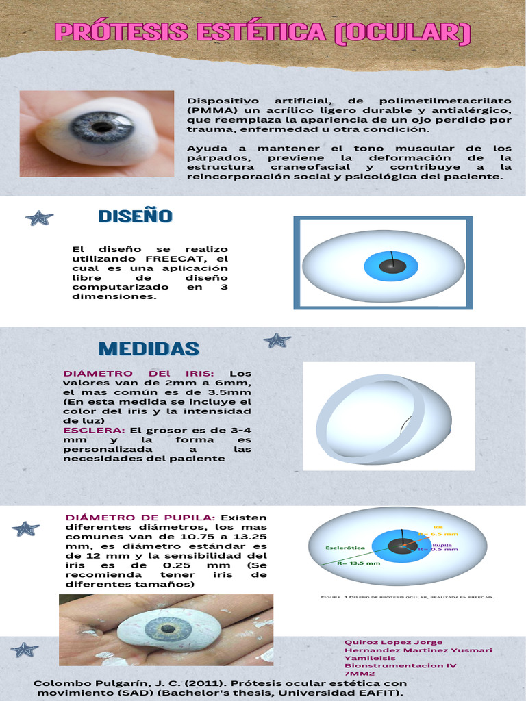 Diseño de Prótesis Ocular Estética | PDF