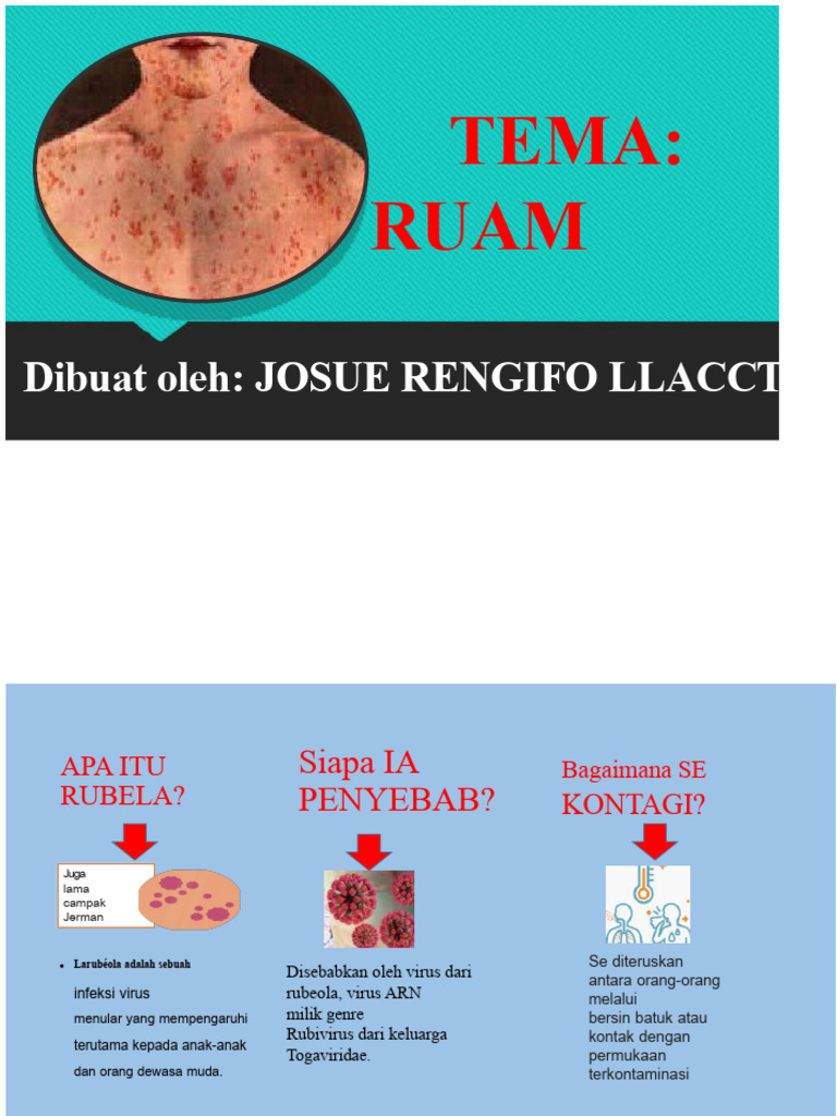 Penyebab dan Gejala Rubella pada Anak | PDF