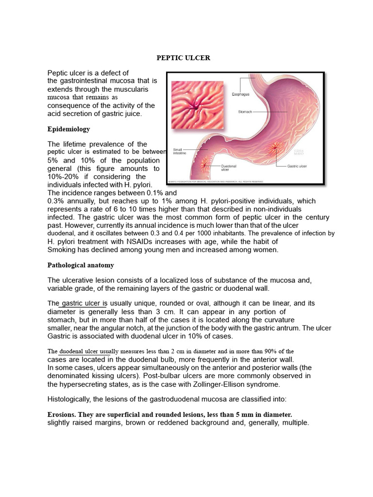 Peptic Ulcer | PDF | Stomach | Indigestion