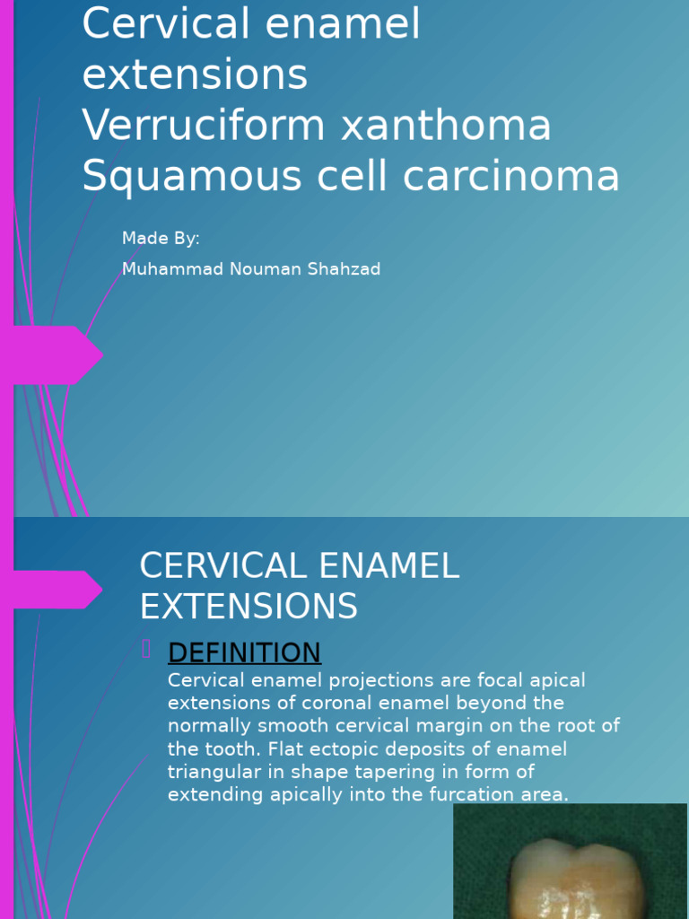 Cervical Enamel Extensions and Related Lesions | PDF | Dental Anatomy ...