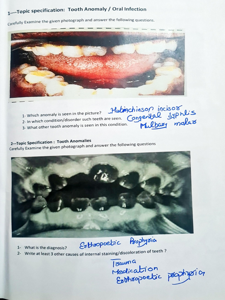 Oral Patho Ospe | PDF