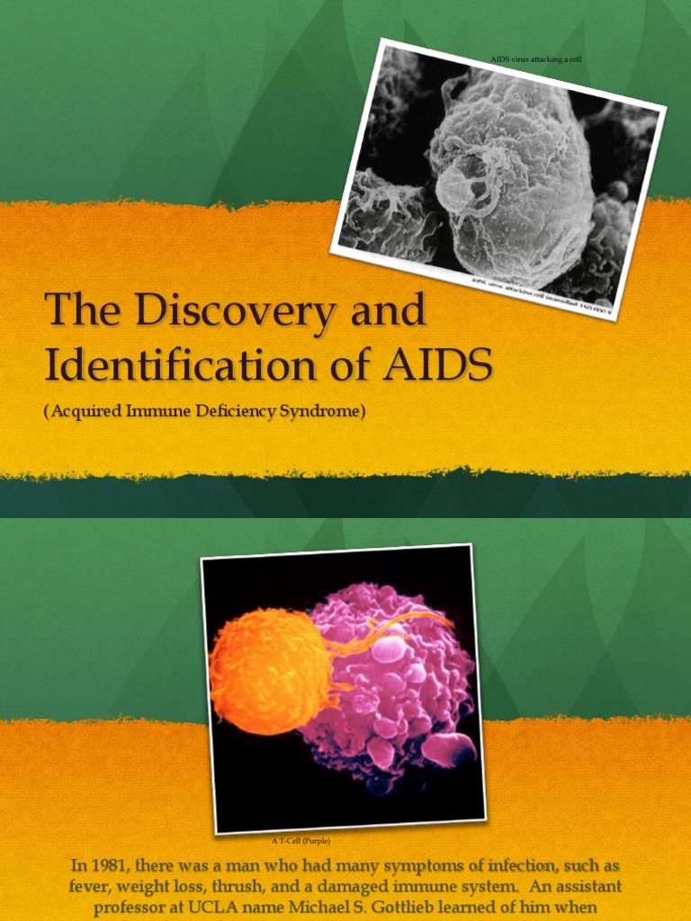 The Discovery and Identification of AIDS: (Acquired Immune Deficiency ...