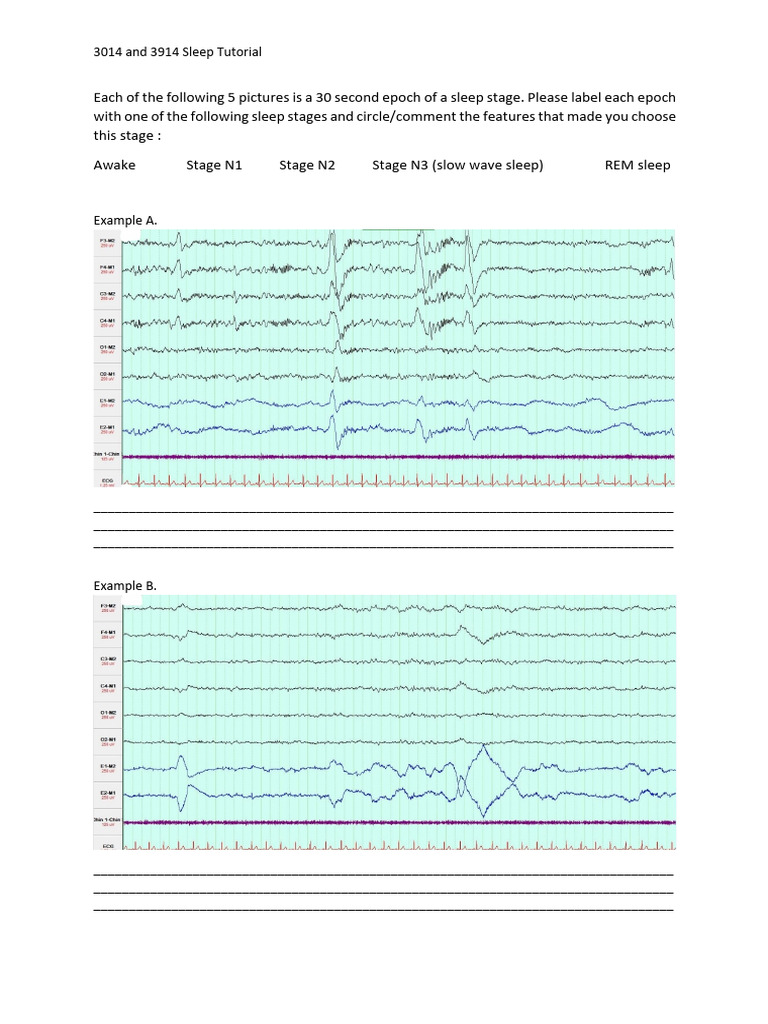 Sleep Stage Labeling Tutorial | PDF