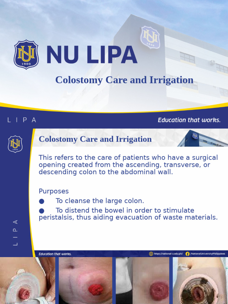Colostomy Care and Irrigation Guide | PDF | Large Intestine ...