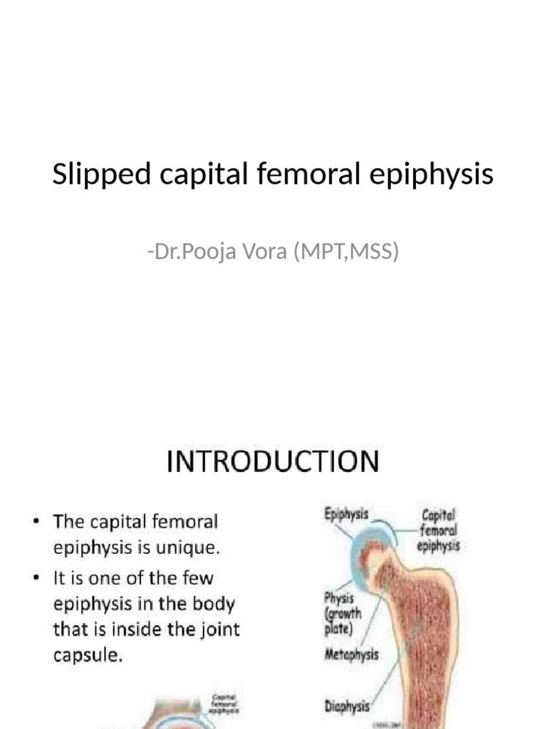 Slipped Capitofemoral Epiphysis | PDF