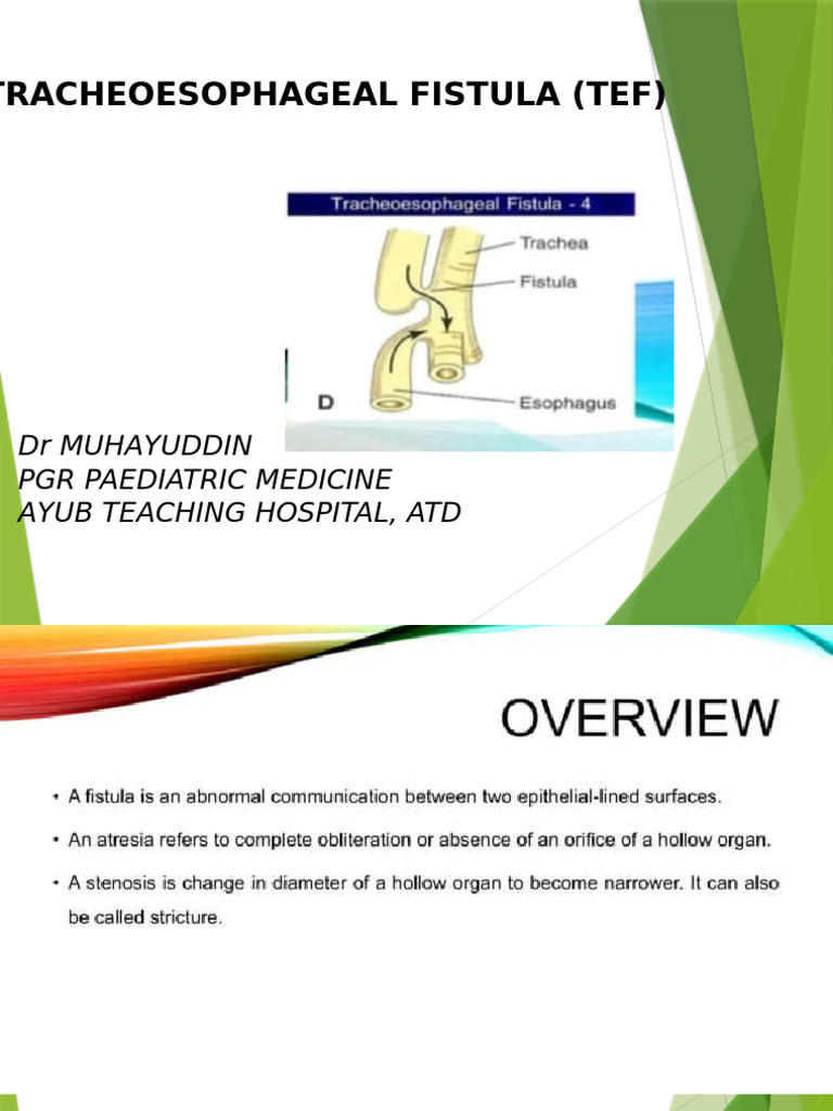 Tracheoesophageal Fistula (Tef) : DR Muhayuddin PGR Paediatric Medicine ...