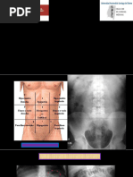 Radiografía de Abdomen y Coprostasis | PDF | Sistema urinario ...