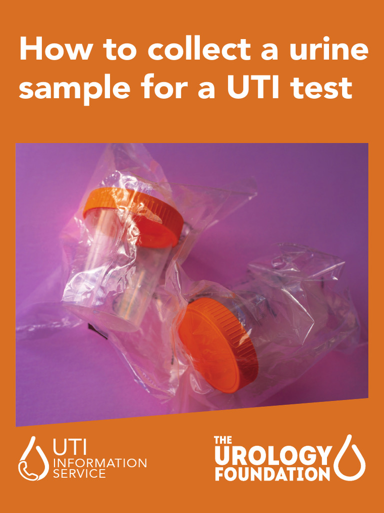 How to Collect a UTI Urine Sample | PDF | Urinary Tract Infection ...
