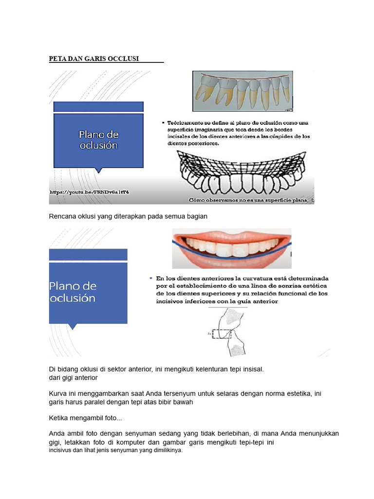 Rencana Dan Kurva Oklusi | PDF