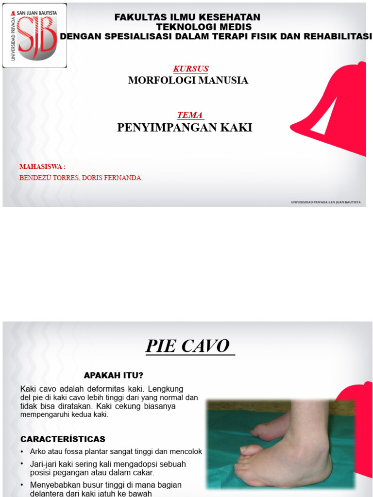 Deformitas Kaki: Kaki Cavo, Datar, dan Lainnya | PDF