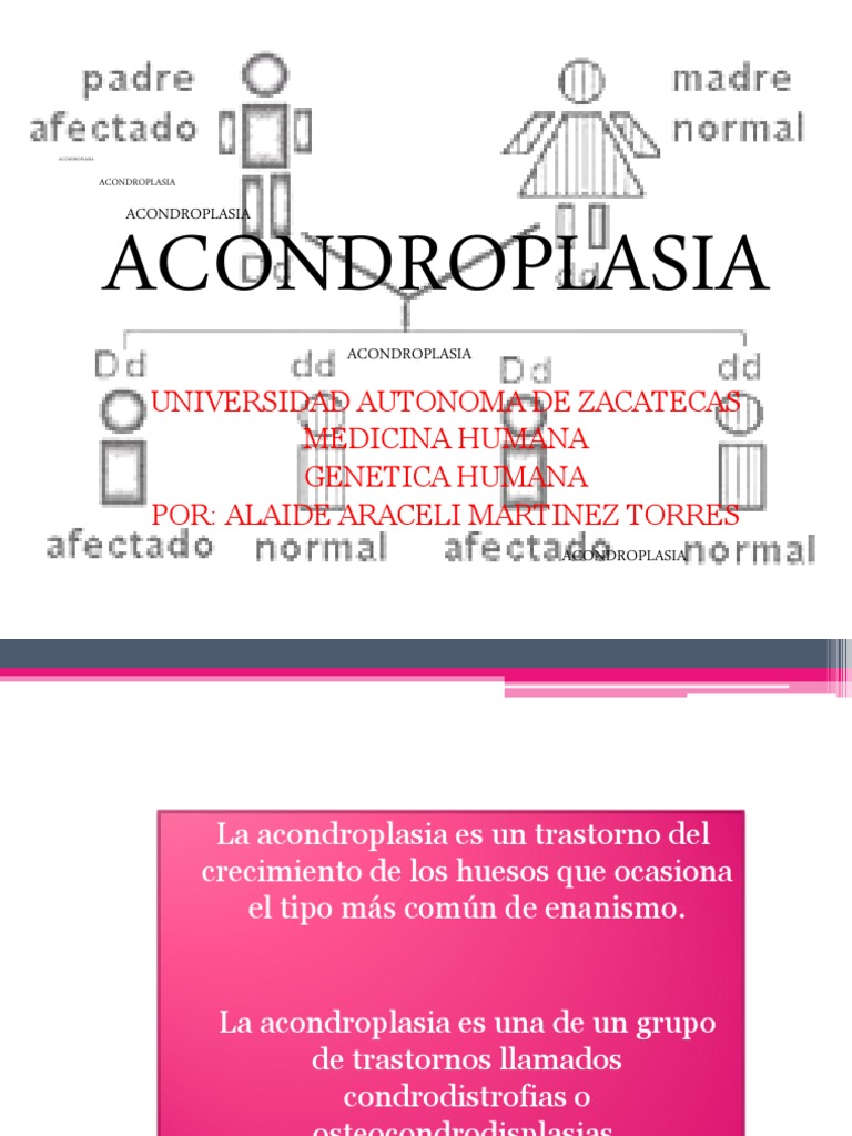 ACONDROPLASIA | PDF | Medicina | Medicina CLINICA
