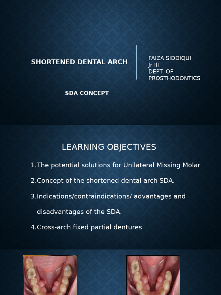 Shortened Dental Arch | PDF | Human Tooth | Medical Specialties