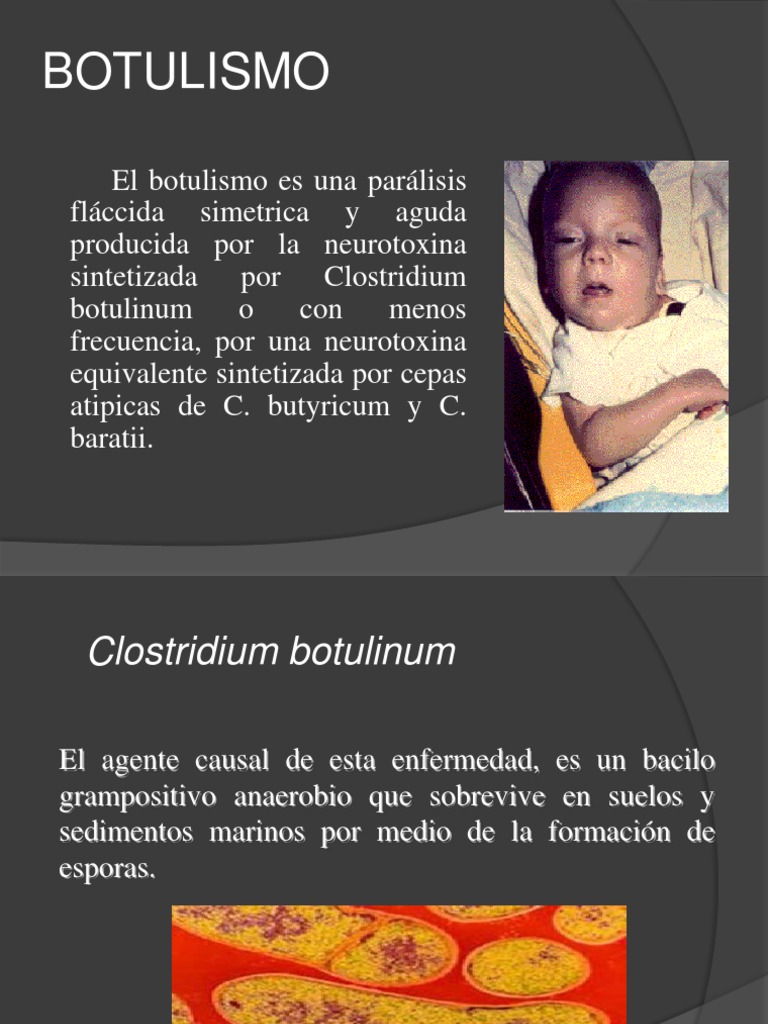 Botulismo | PDF | Medicina | Medicina CLINICA