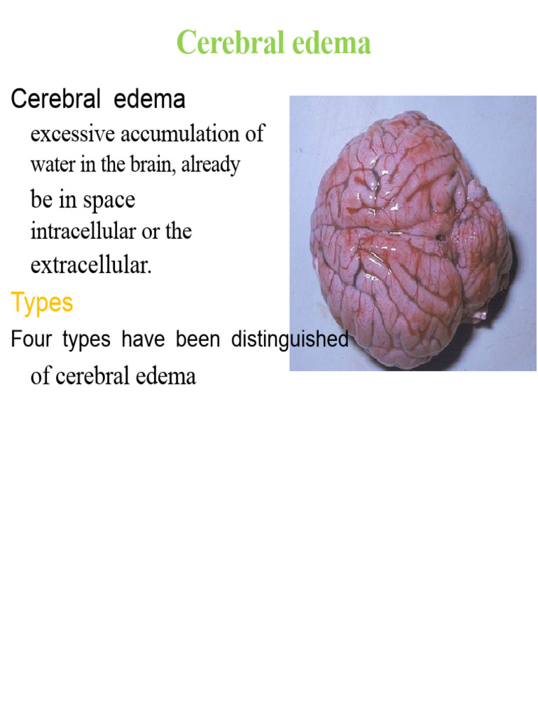 Cerebral Edema Slide | PDF | Edema | Medical Specialties