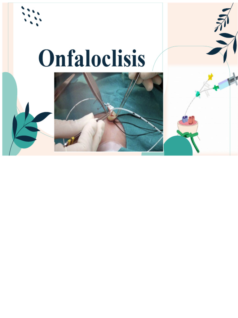 Umbilical Catheter | PDF | Vein | Intravenous Therapy