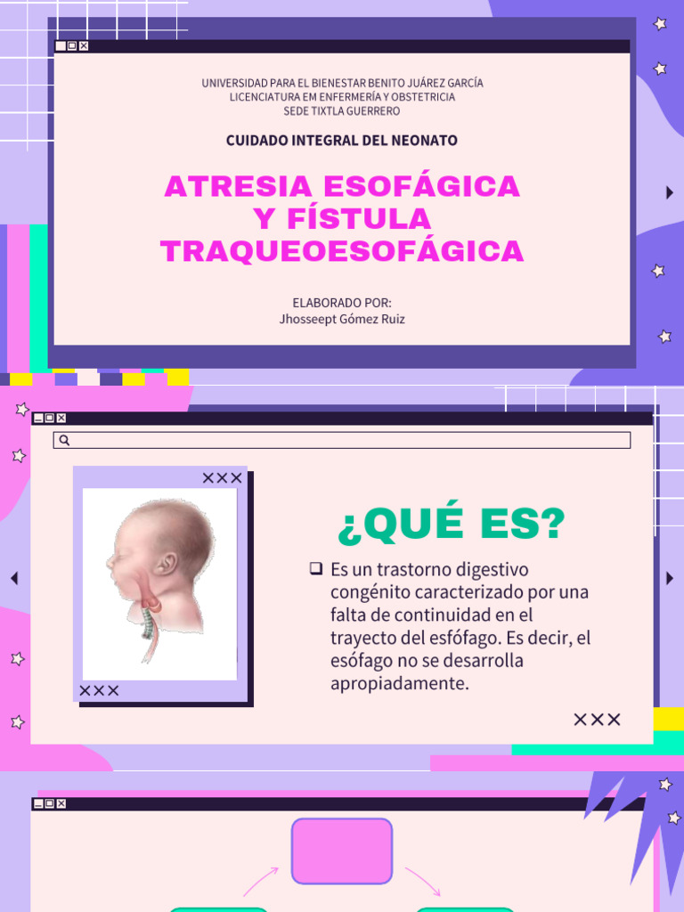 Atresia Esofágica: Causas y Tratamiento | PDF