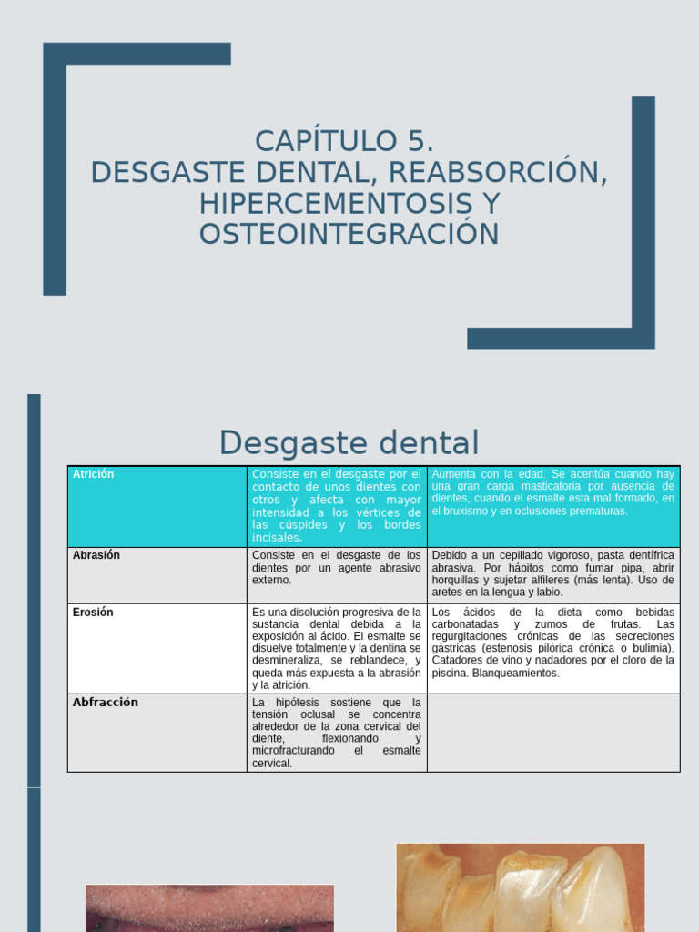 Capítulo 6.desgaste Dental, Reabsorción, Hipercementosis y ...