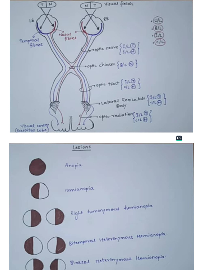 #Visual Pathway #Accommodation #Pupillary Light Reflex #Refractory | PDF