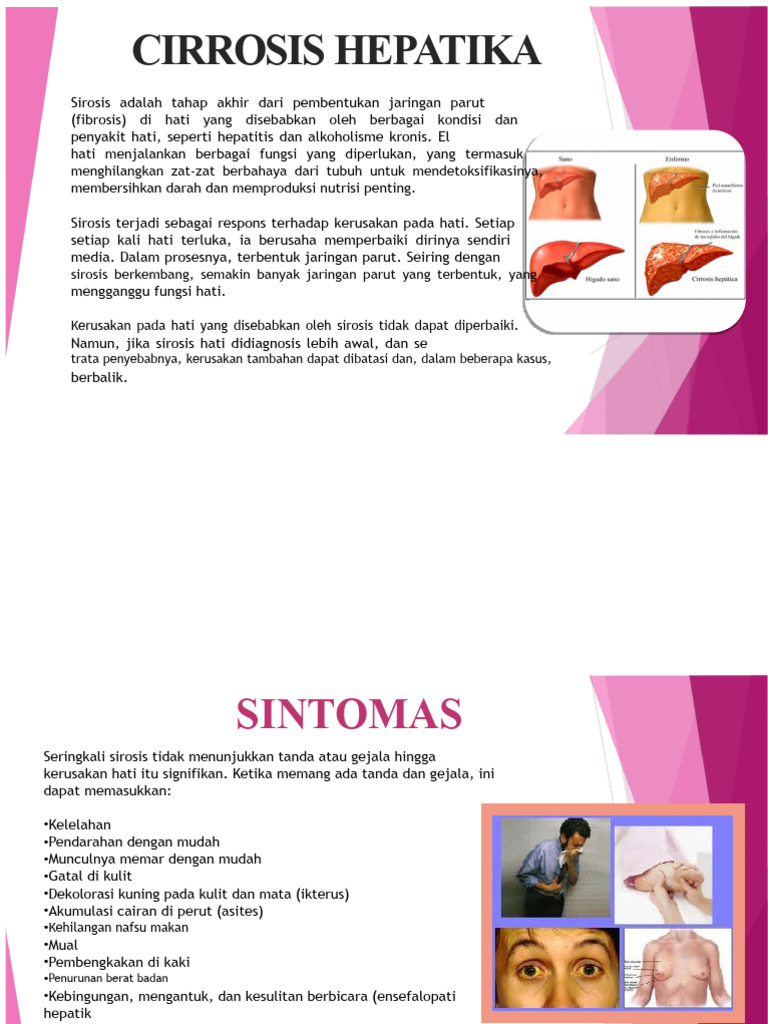 Panduan Lengkap Sirosis Hepatika | PDF