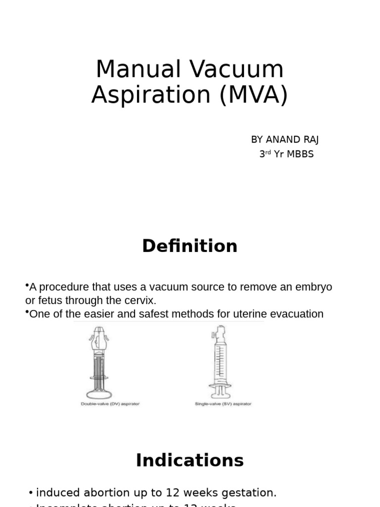 Manual Vacuum Aspiration Procedure Guide | PDF | Abortion | Uterus