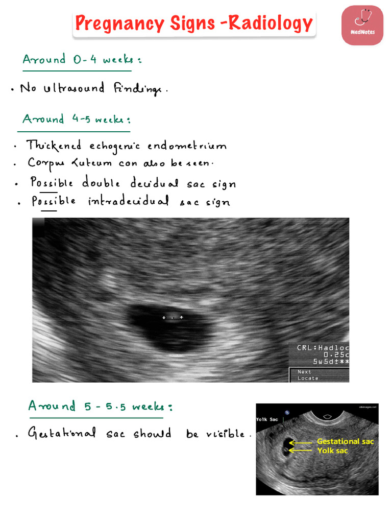 Early Pregnancy Ultrasound Signs | PDF | Mammalian Pregnancy | Medical ...