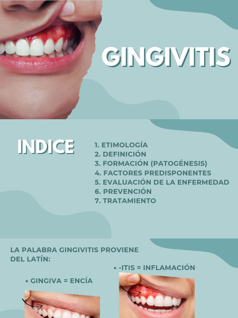 Gingivitis | PDF | Higiene oral | Odontología