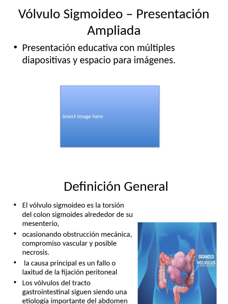 Exposición Vólvulo Sigmoide. | PDF | Intestino grueso | Septicemia