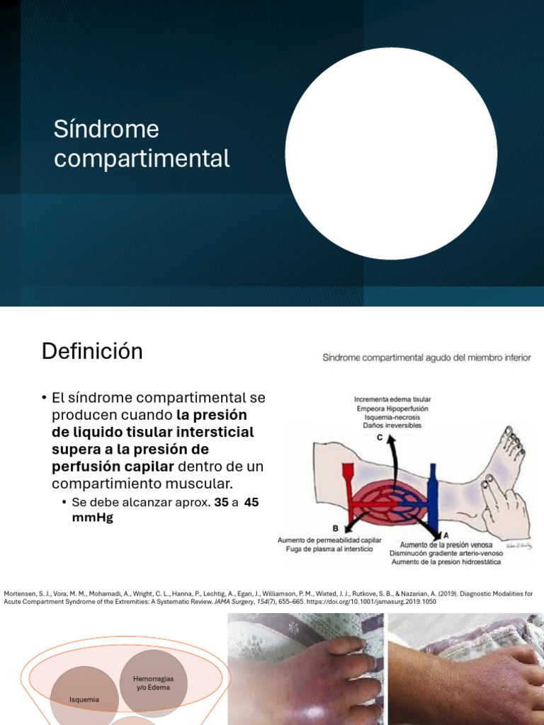 Síndrome Compartimental: Causas y Diagnóstico | PDF | Traumatologia ...