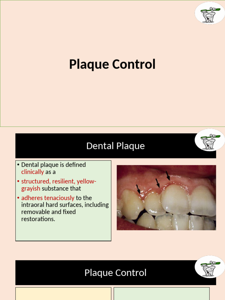Plaque Control - Periodontics Final Year | PDF | Toothbrush | Dental ...