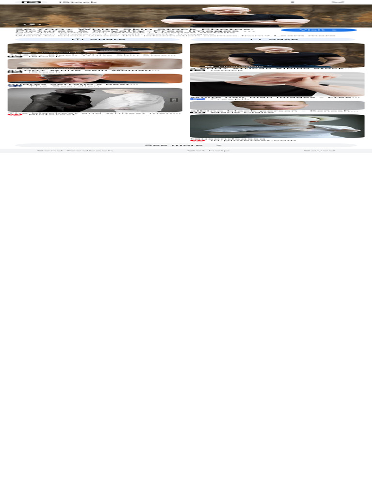 Whitest Person in The World - Google Search | PDF | Human Skin Color
