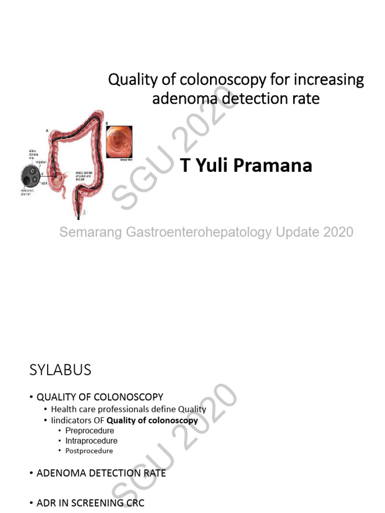 Colonoscopy Quality and Adenoma Detection | PDF | Colonoscopy ...