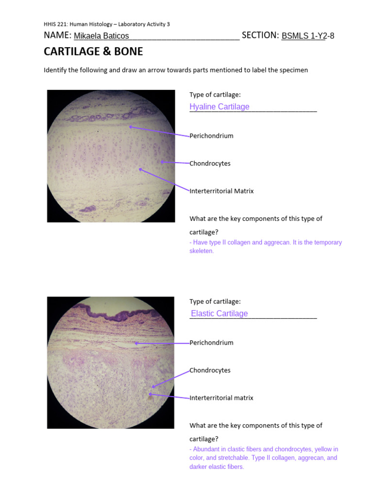 HHIS221 Act 6 - Bone & Cartilage.pdf_20250326_231058_0000 | PDF | Cartilage | Histology