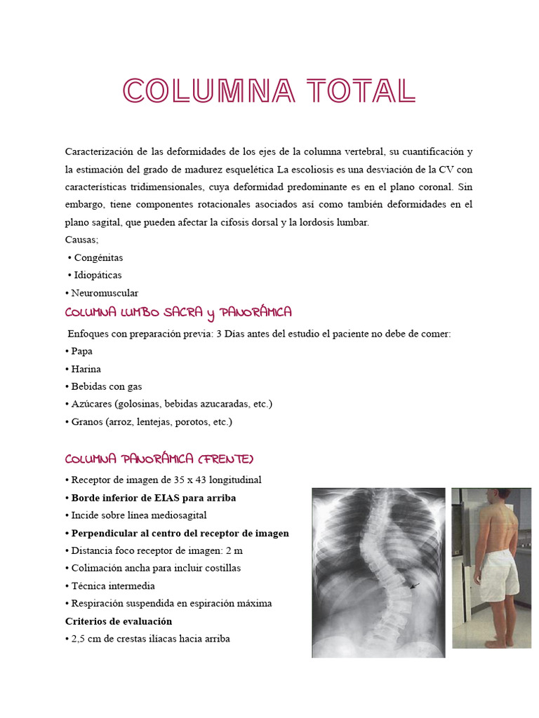 Evaluación y Tratamiento de Escoliosis | PDF | Escoliosis | Vértebra