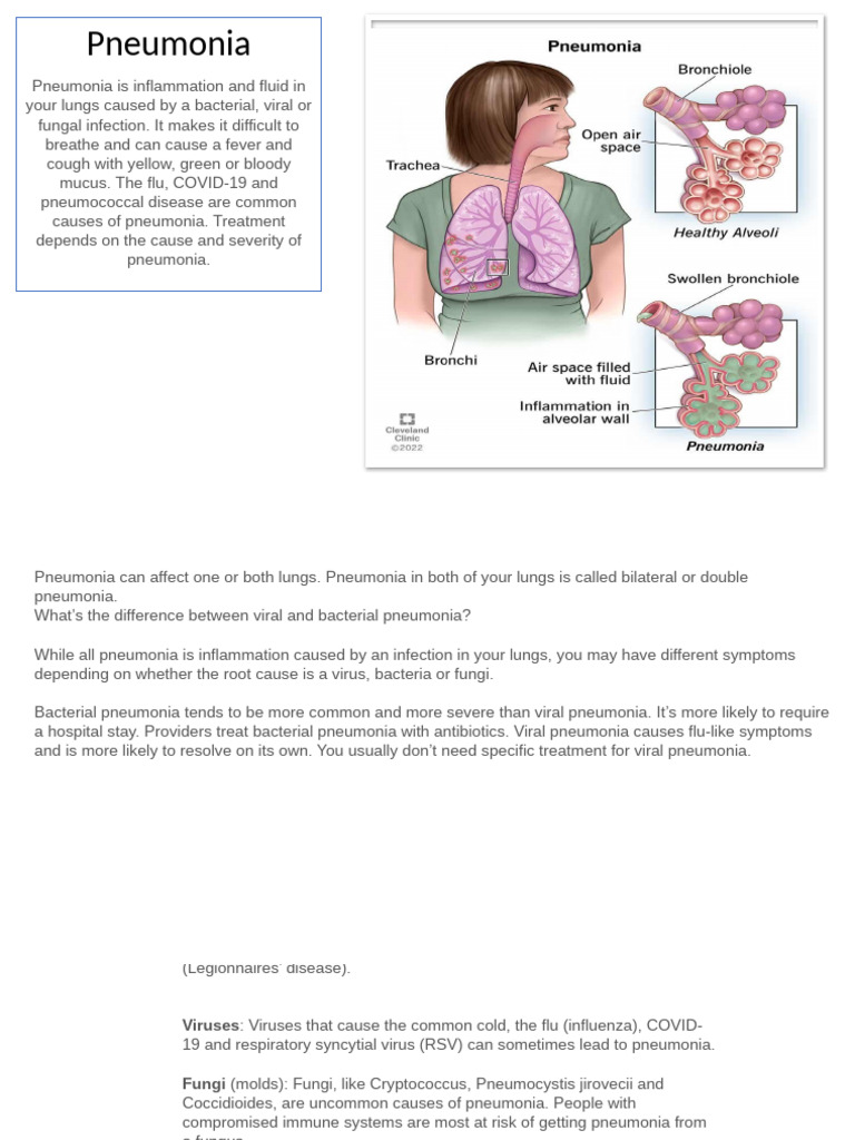 Understanding Pneumonia Types and Causes | PDF