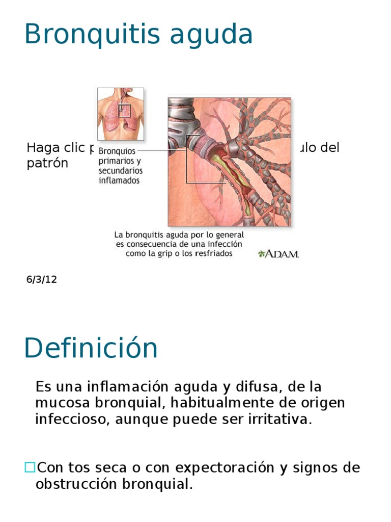 Bronquitis aguda | Tos | Resfriado comun
