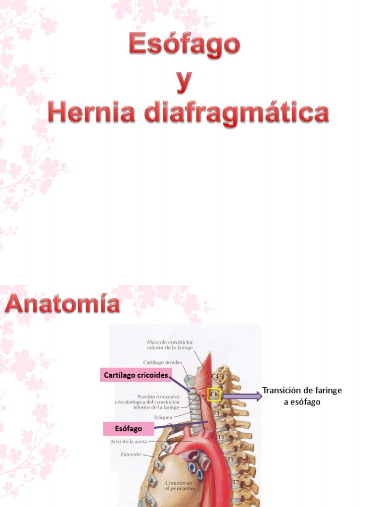 Esófago y Hernia Diafragmática! | PDF | La enfermedad por reflujo ...