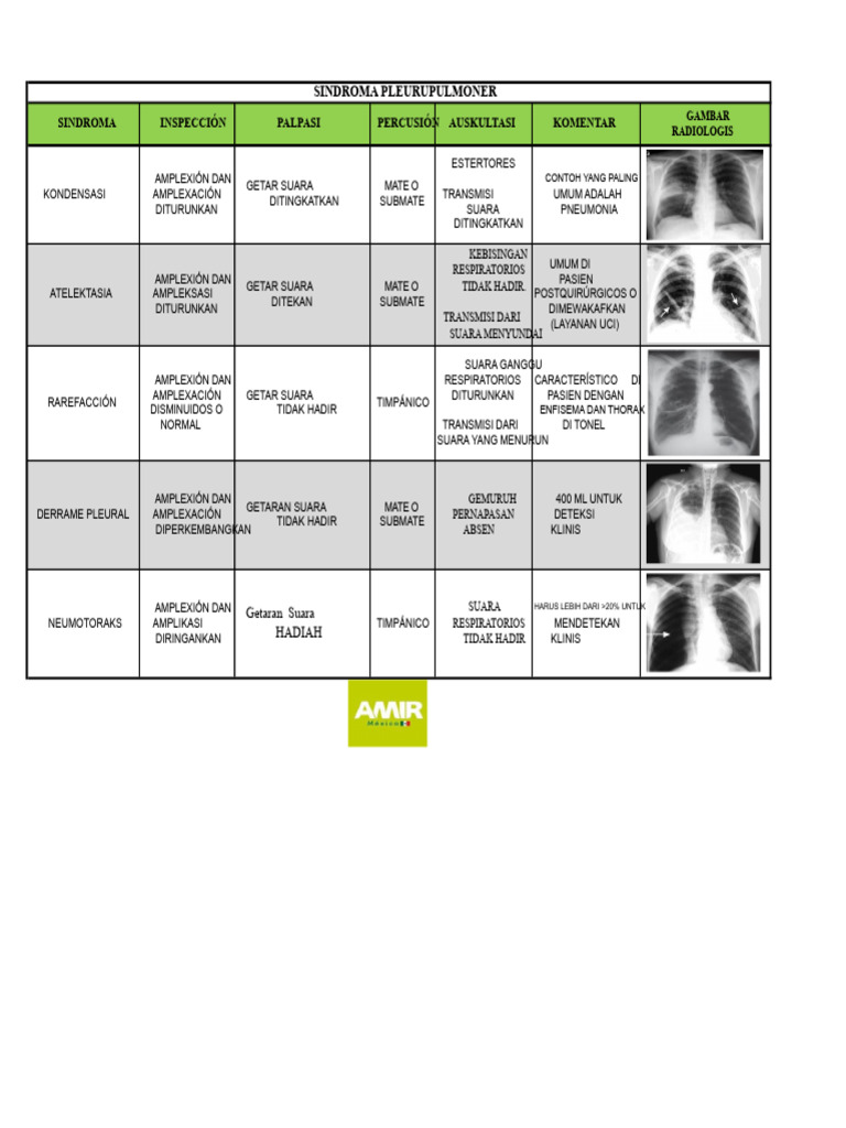 Sindrom Pleuropulmoner 2021 | PDF