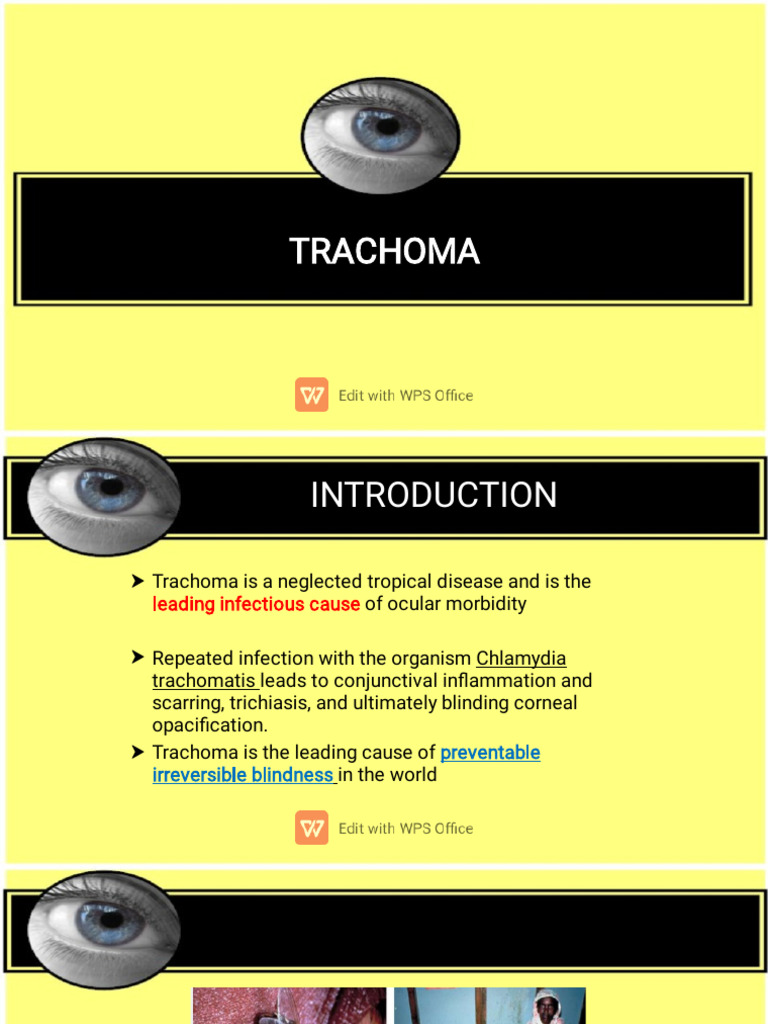 Trachoma | PDF
