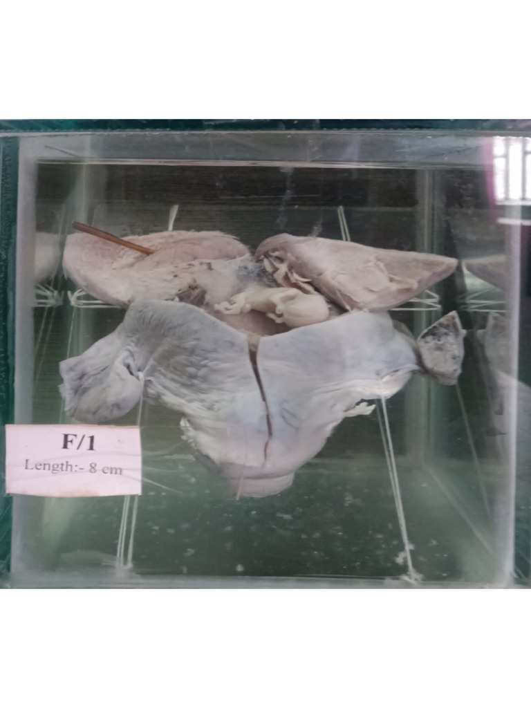 Foetus Age Estimation | PDF