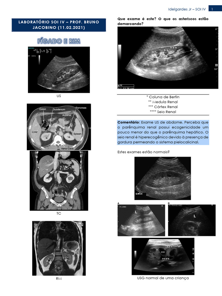 4 - SEMANA FÍGADO E RIM 2 | PDF | Necrose | Especialidades médicas