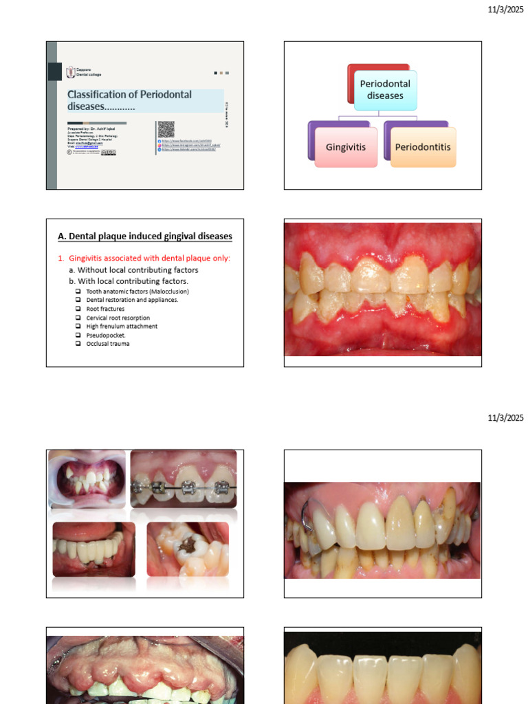 Classification of Periodontal Diseases | PDF | Periodontology | Dentistry