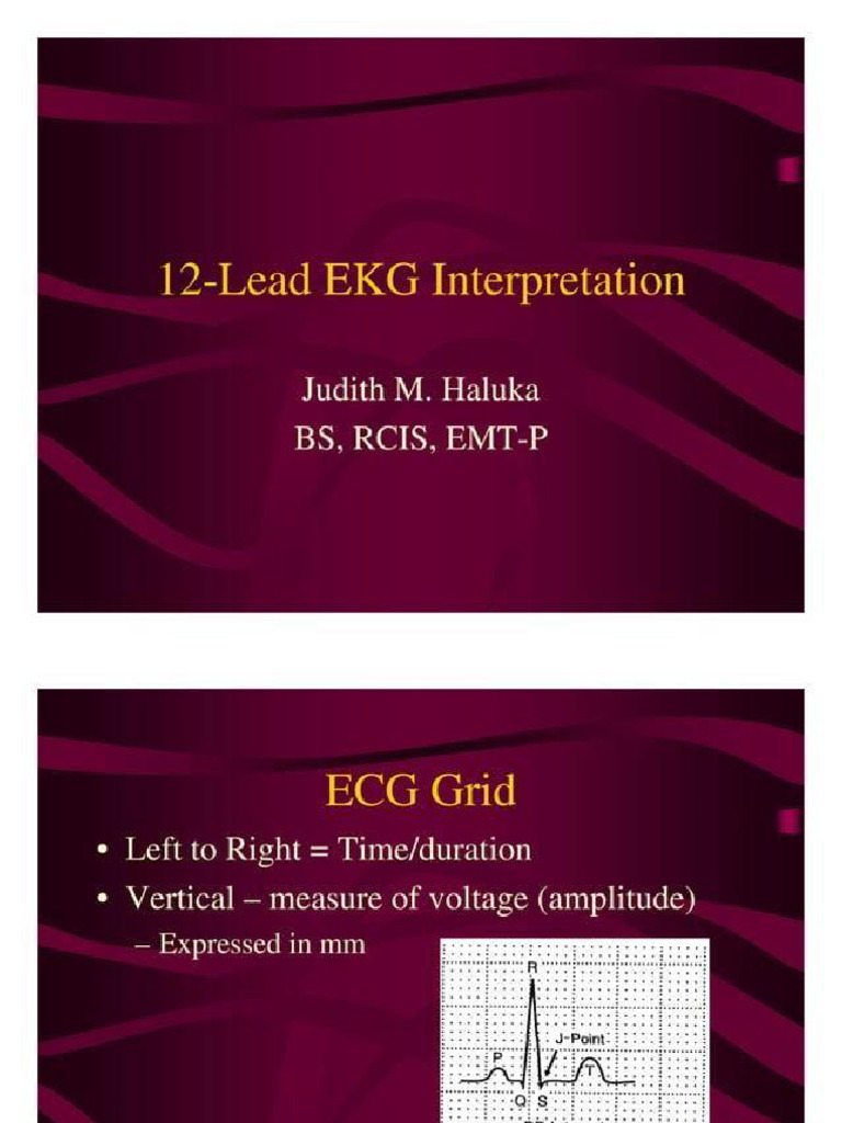 Ecg 11 | PDF