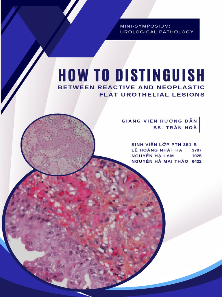 How To Distinguish Between Reactive and Neoplastic Flat Urothelial ...