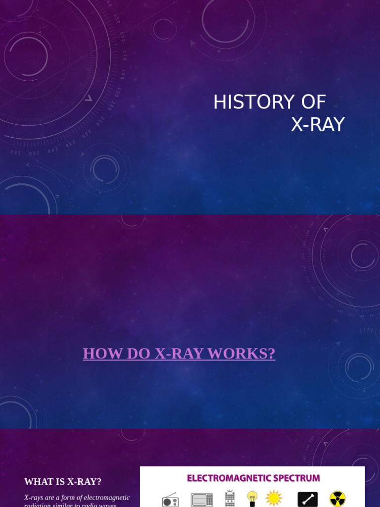 The Discovery of RayS | PDF | X Ray | Radiation