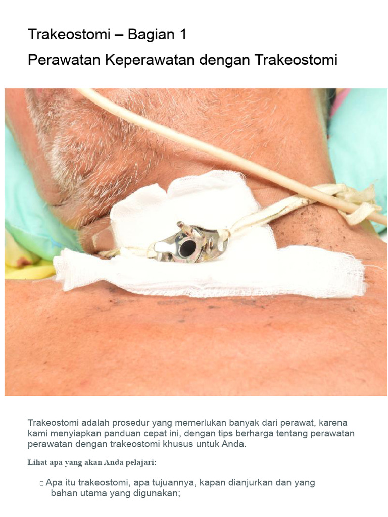 Perawatan Keperawatan Trakeostomi 101 | PDF