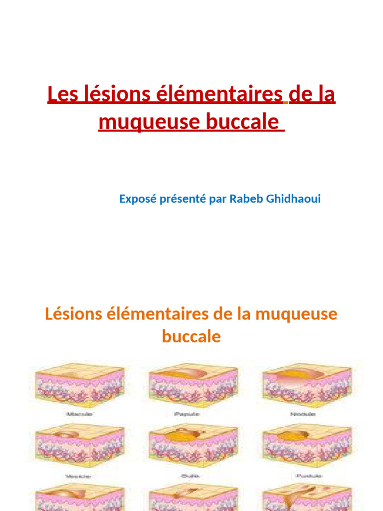 Lésions élémentaires de la muqueuse buccale | PDF | Muqueuse ...