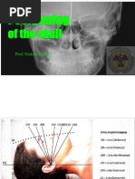 PA Axial Caldwell Method Overview | PDF | Skull | Radiography