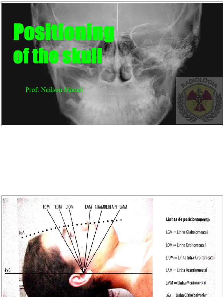 skull positioning.pdf | PDF | Orbital Inclination | Anatomical Terms Of ...