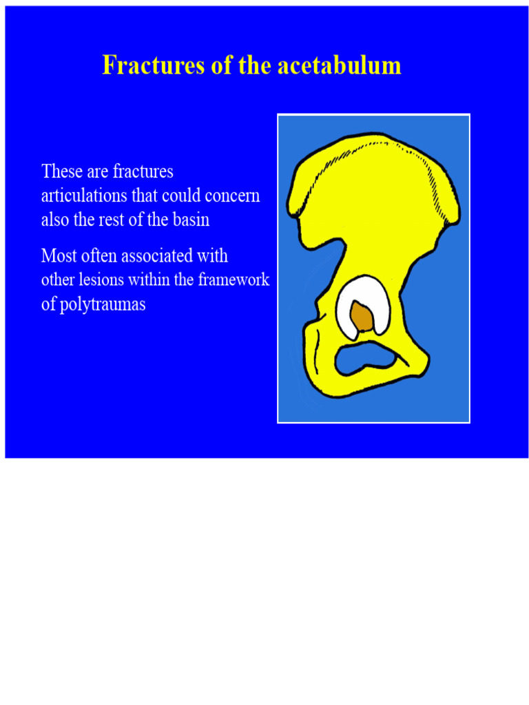 04 - Fractures of The Acetabulum | PDF | Anatomical Terms Of Location ...