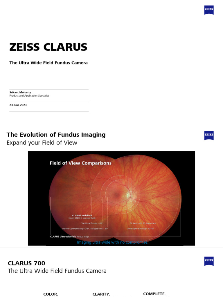Zeiss Clarus (Team Training) | PDF | Retina | Vision